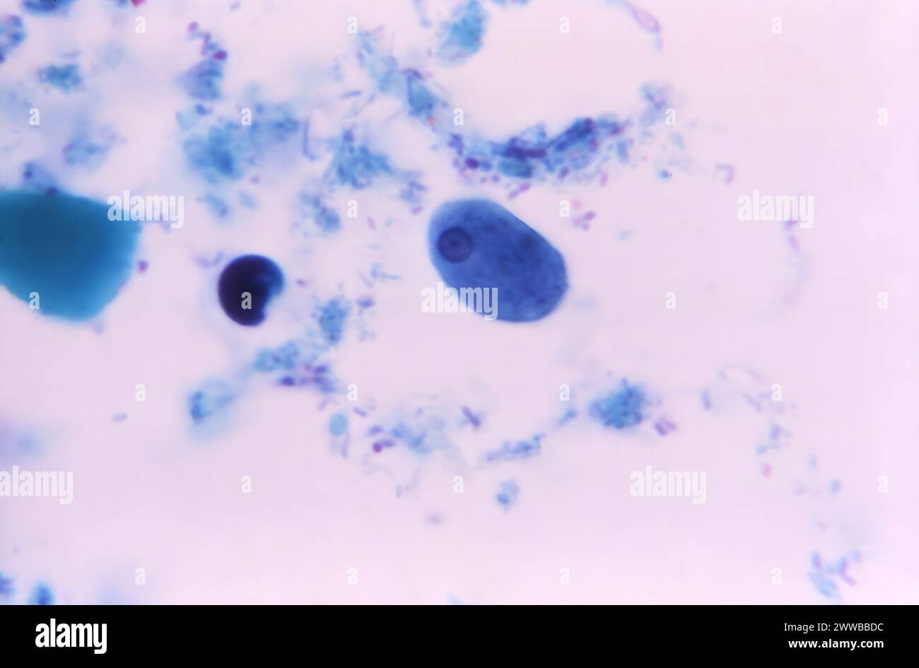 Parasitic amoeba entamoeba histolytica Banque de photographies et d ...