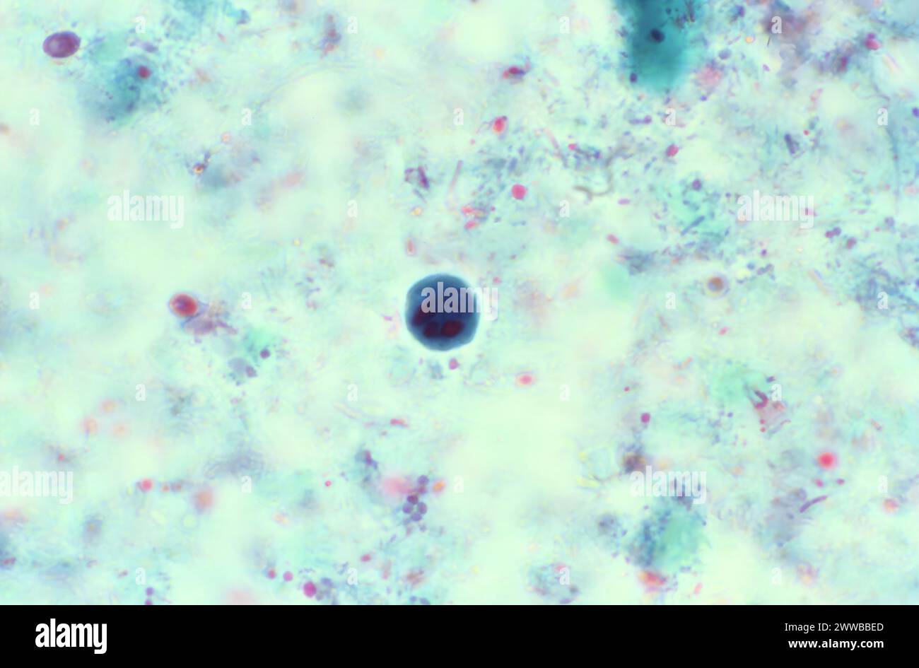 Parasitic amoeba entamoeba histolytica Banque de photographies et d ...