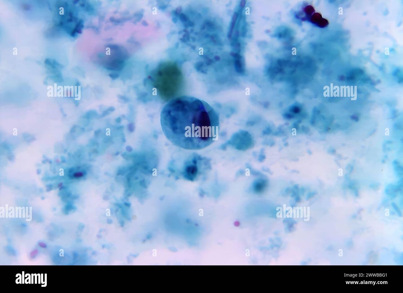 Entamoeba histolytica cyst Banque de photographies et d’images à haute ...