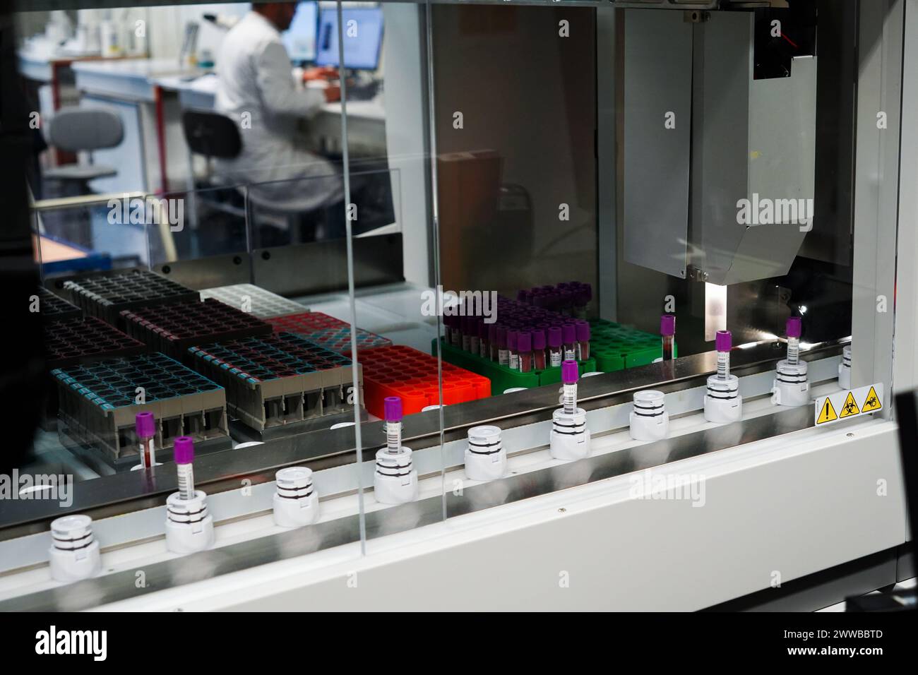 Plate-forme technique du laboratoire Inovie 34 . Trieur de tubes d ...