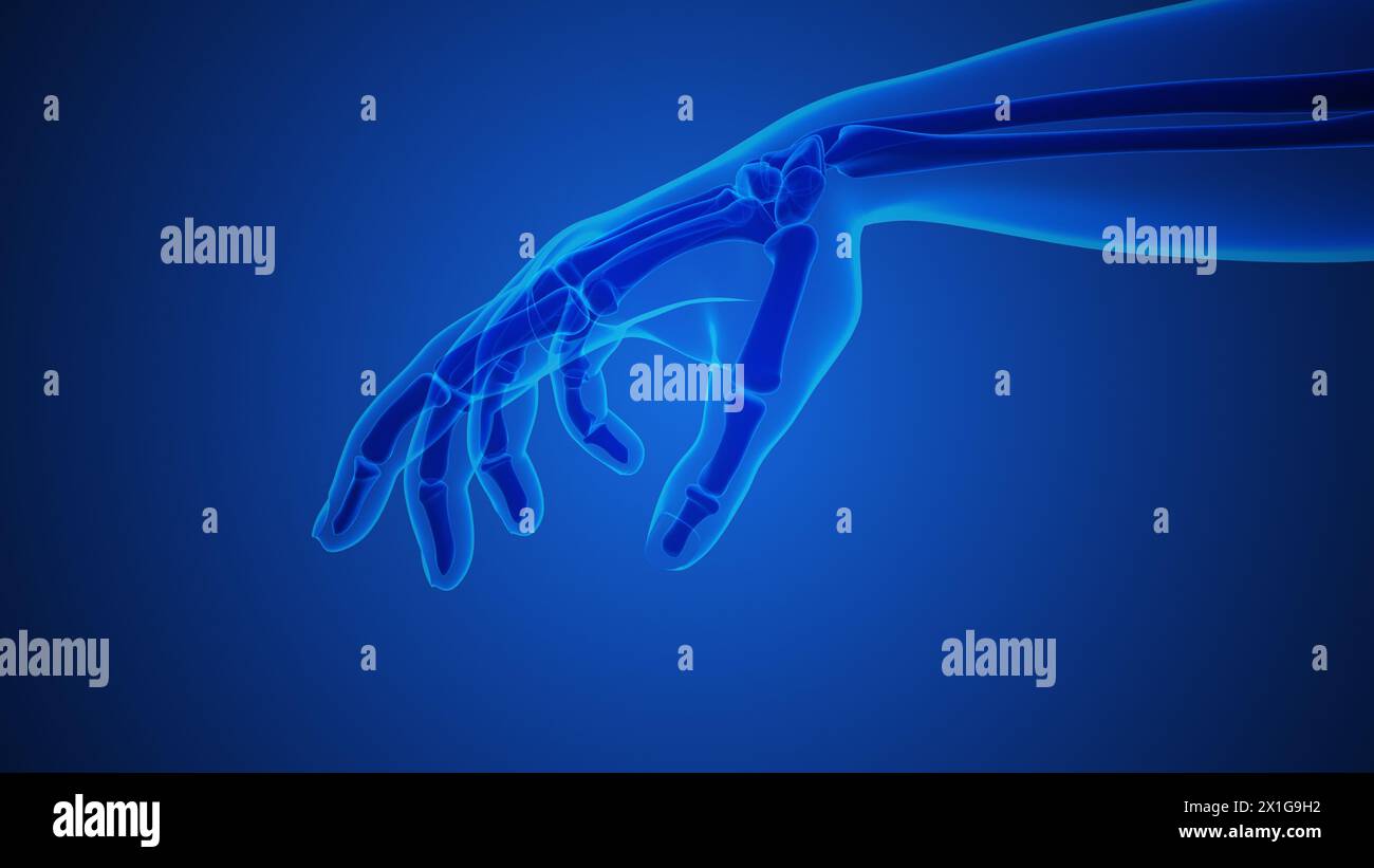 Arthrite de l'articulation du doigt et du pouce Photo Stock - Alamy