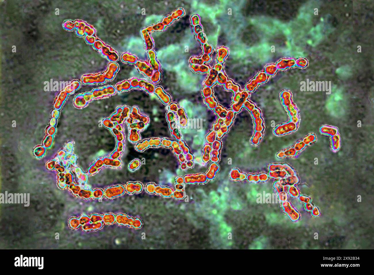 Streptocoques pyogenes du groupe A. Elle est la cause d'infections ...