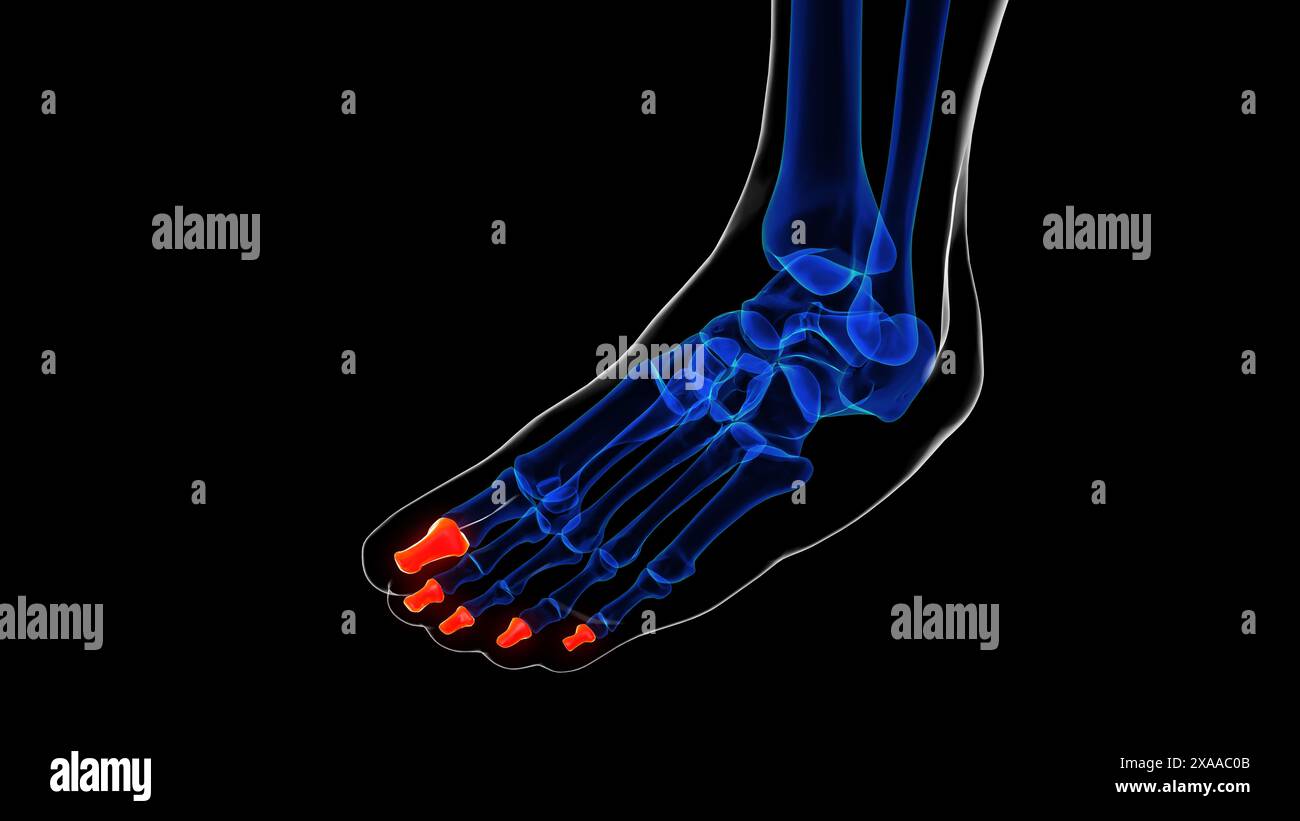 Metatarsophalangeal articulation Banque de photographies et d’images à ...