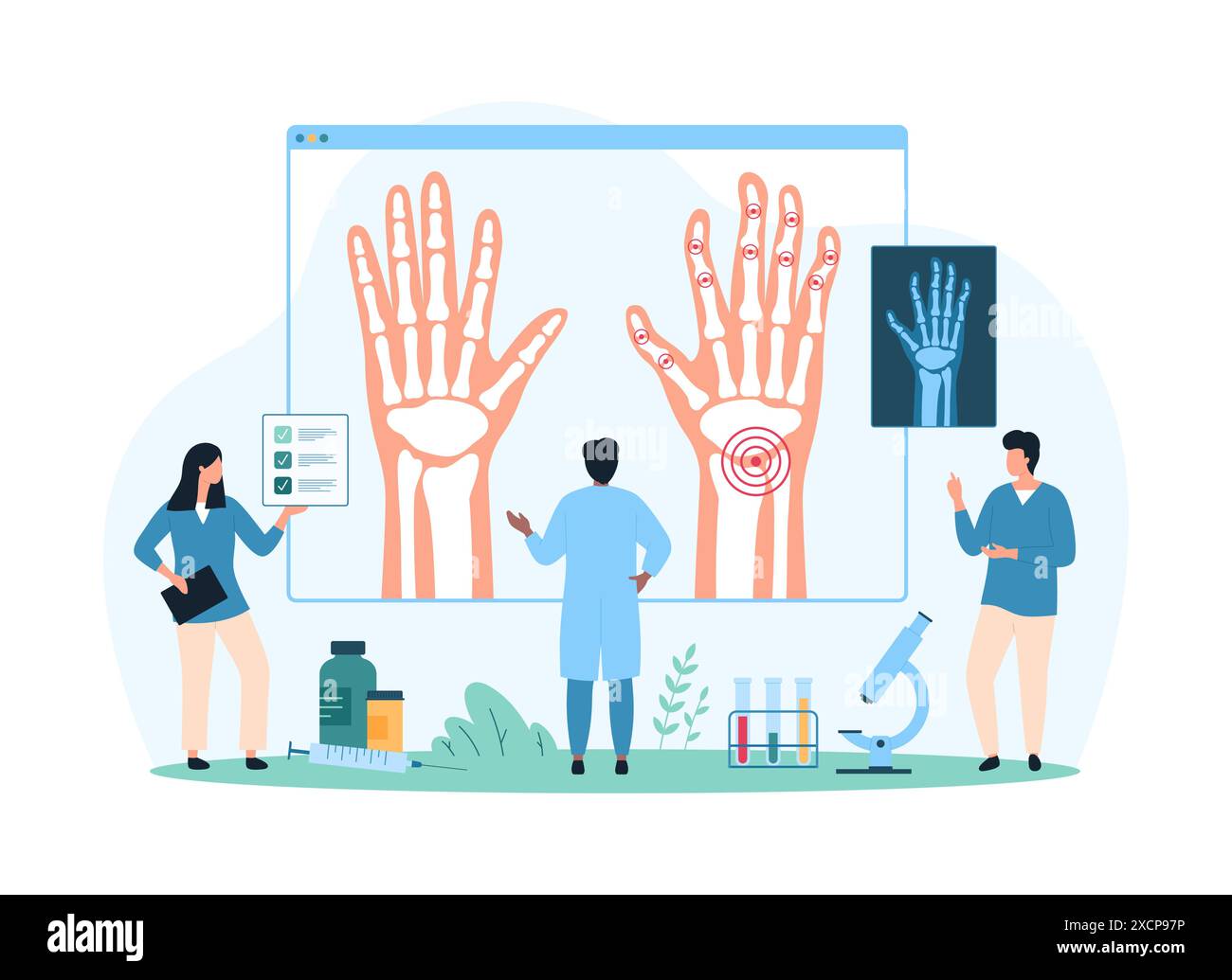 Diagnostic et traitement de l'arthrose, de la polyarthrite rhumatoïde ...