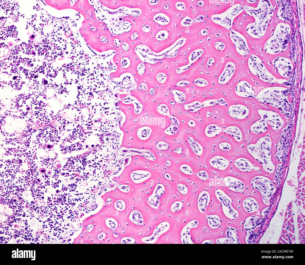 Micrographie lumineuse d'une diaphyse transversale d'un os immature en ...