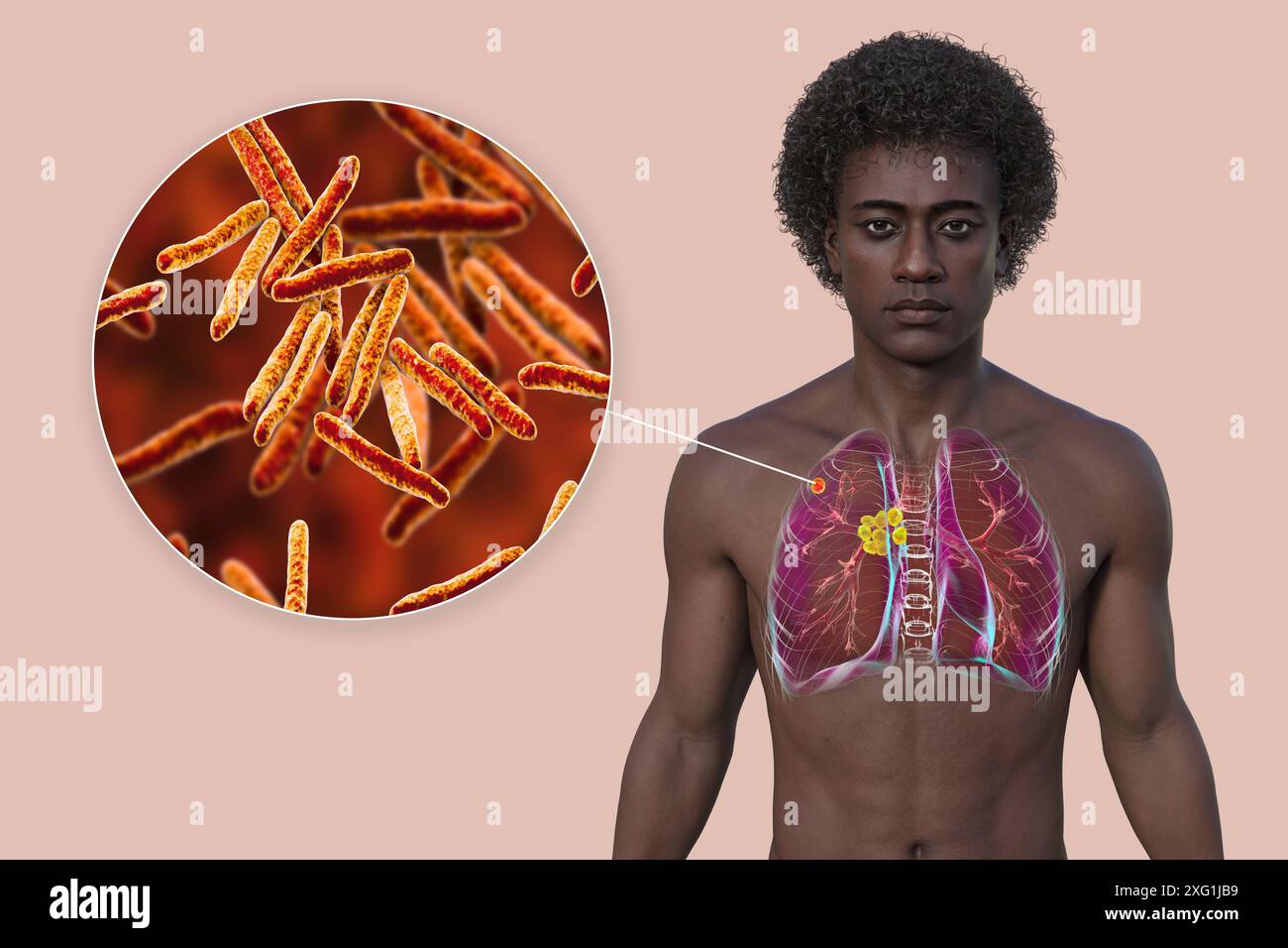Illustration de la cavité thoracique (thorax) d'un homme révélant un ...