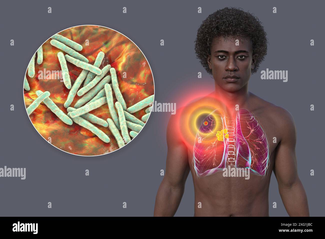 Illustration de la cavité thoracique (thorax) d'un homme révélant un ...