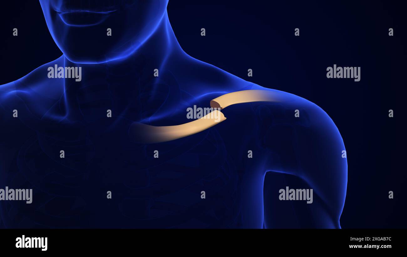 Fractura de clavicula paciente Banque de photographies et d’images à haute résolution - Alamy