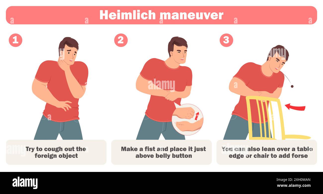 Heimlich manoeuvre Banque d'images détourées - Alamy