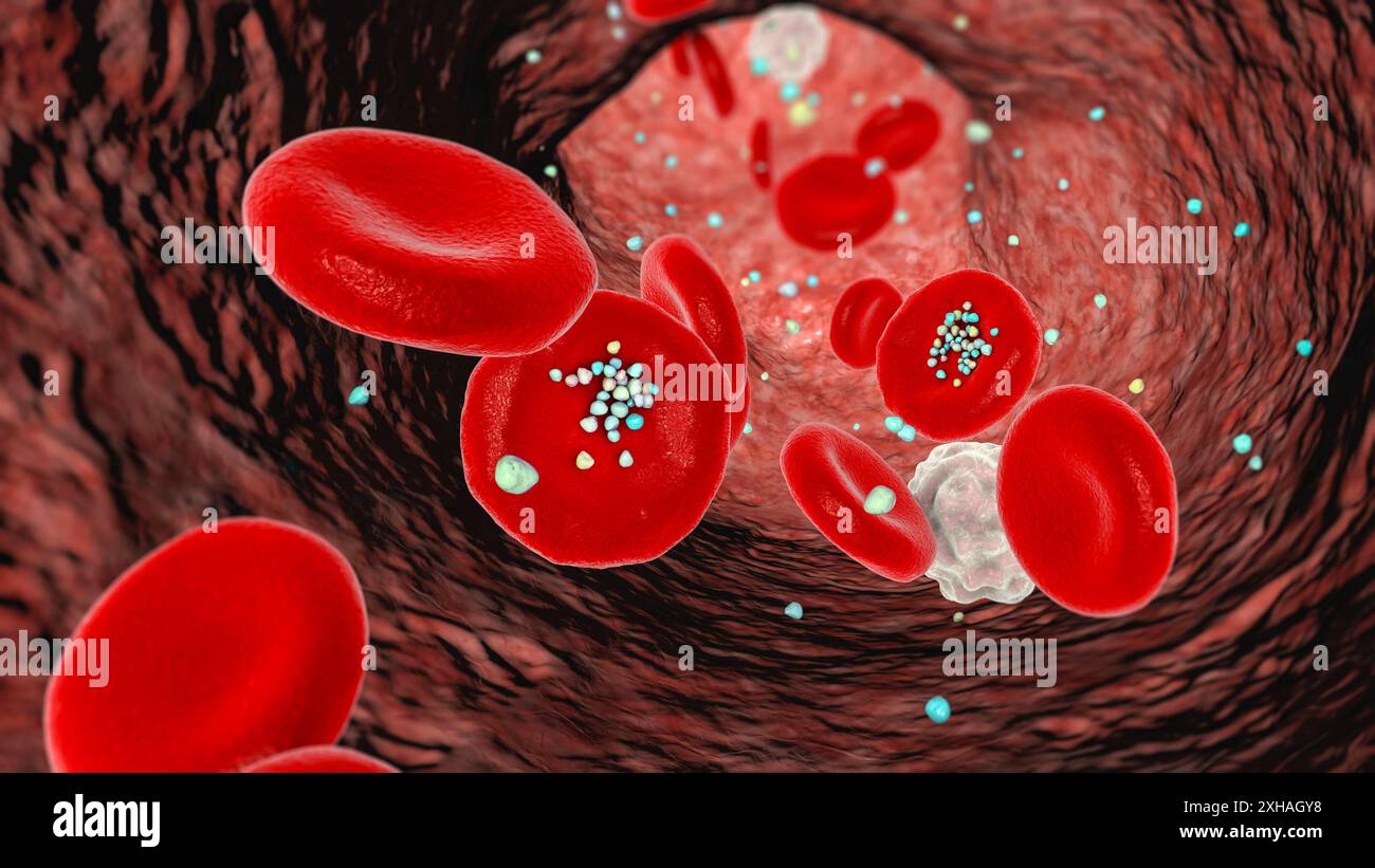 érythrocytes avec microparticules de plastique Banque de photographies ...