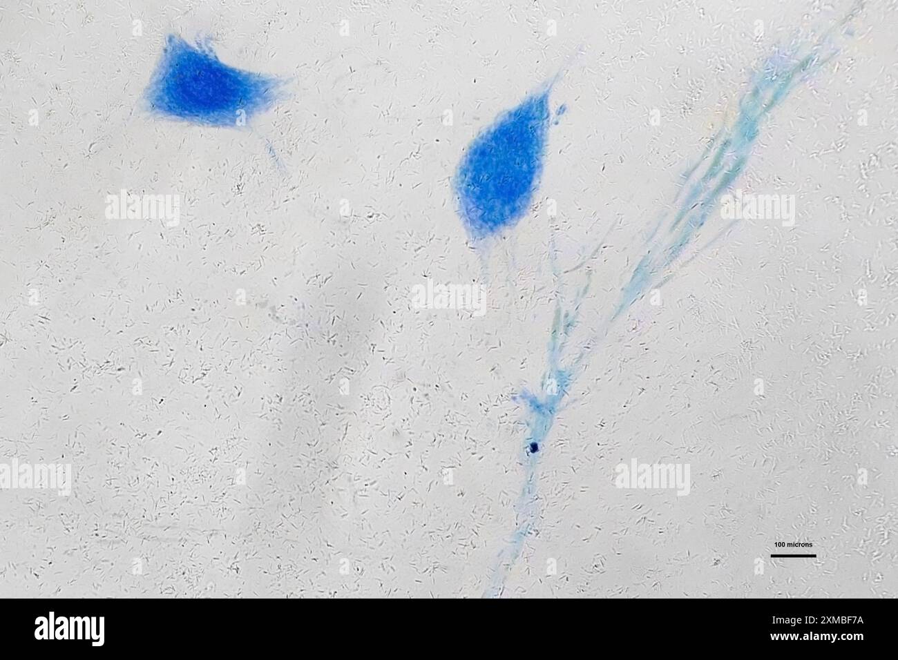 Cellule nerveuse au microscope Banque de photographies et d’images à ...