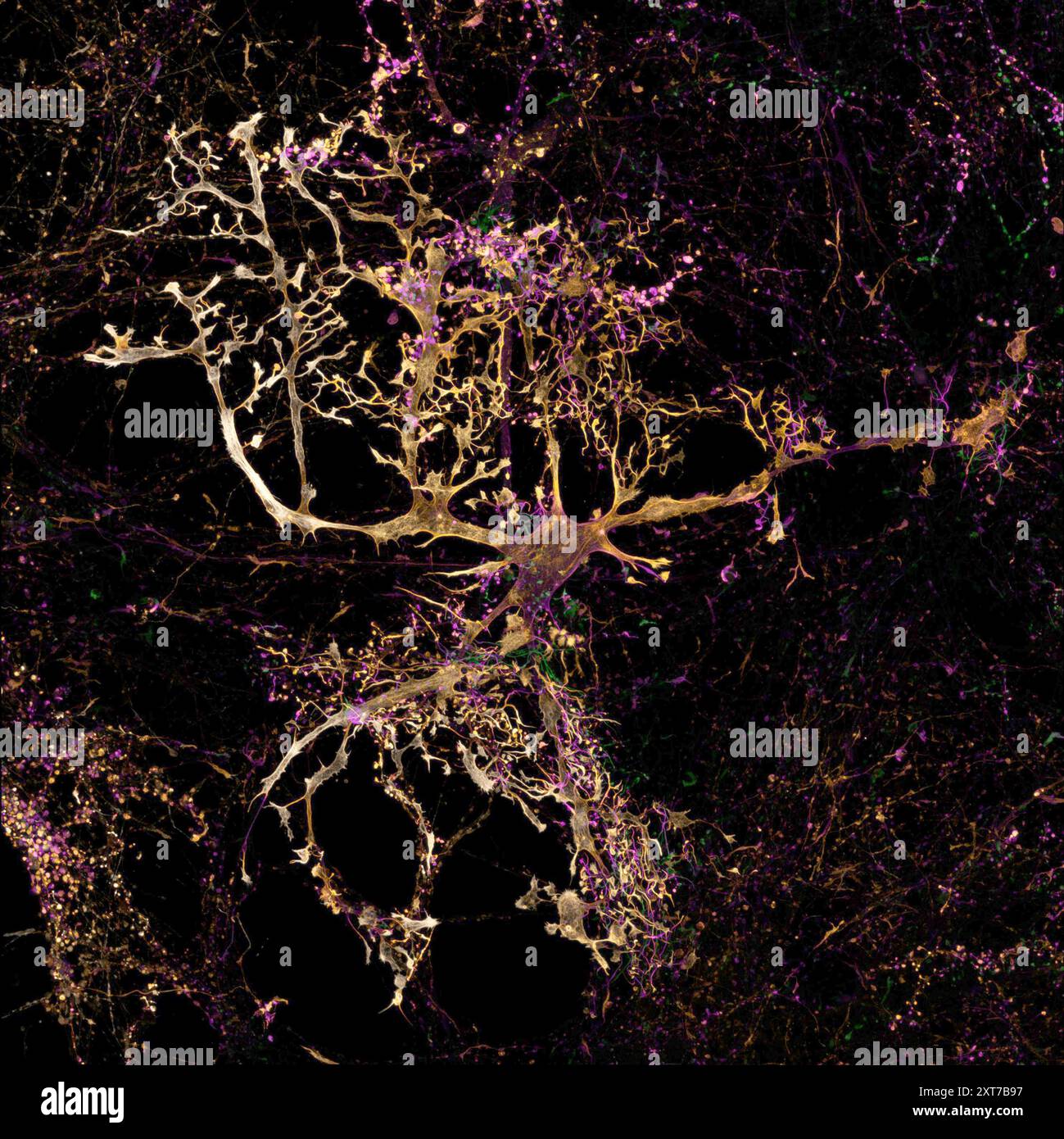 Micrographie confocale des cellules astrocytaires. Les astrocytes sont ...