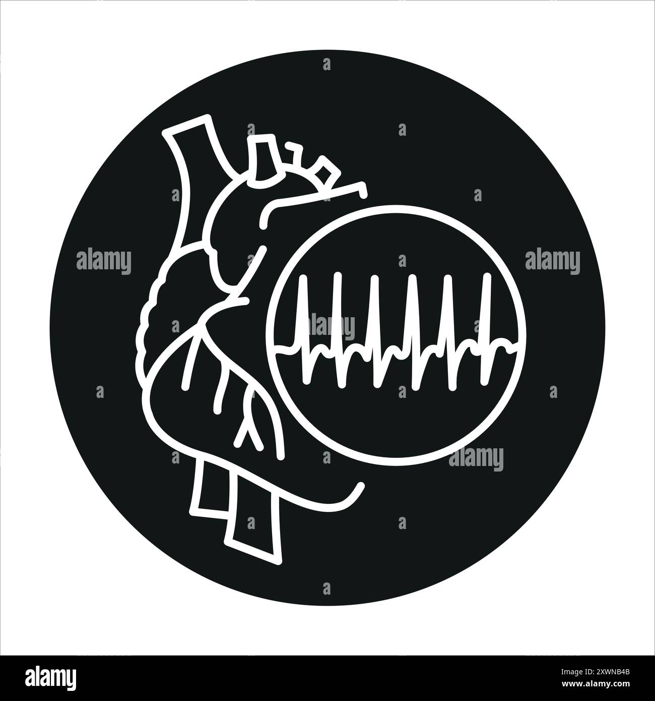 Electrocardiograma anormales Banque d'images vectorielles - Alamy