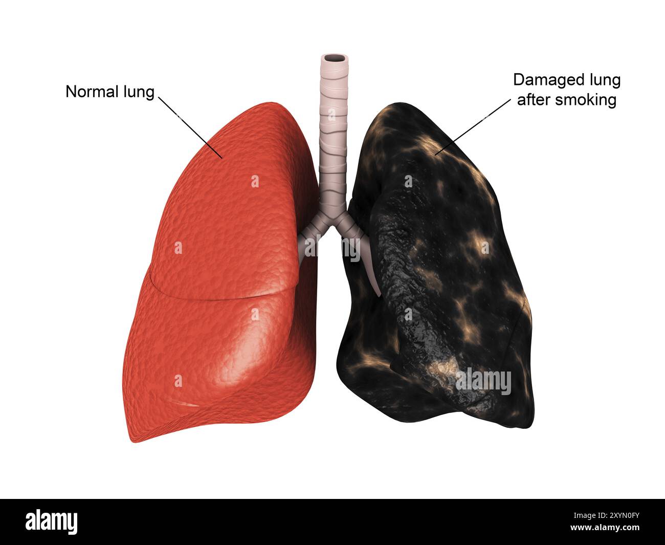 Fumeurs de poumons Banque de photographies et d’images à haute ...
