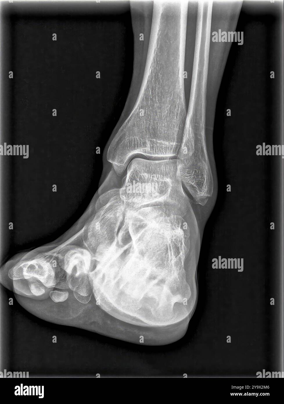 Radiographie détaillée de la structure osseuse du pied et de la ...