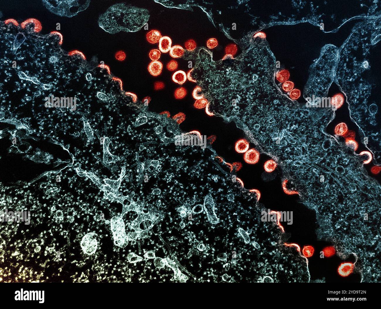 Micrographie électronique par transmission de particules de virus VIH-1 ...