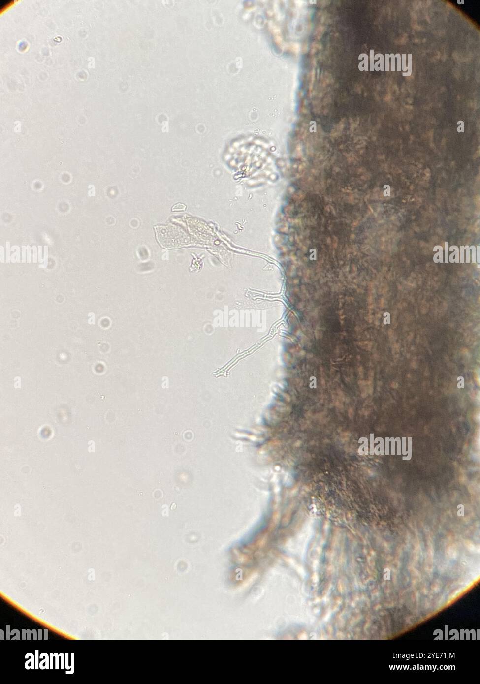 Image dermatoscopique d'un cheveu d'un garçon hispanique de 9 ans ...