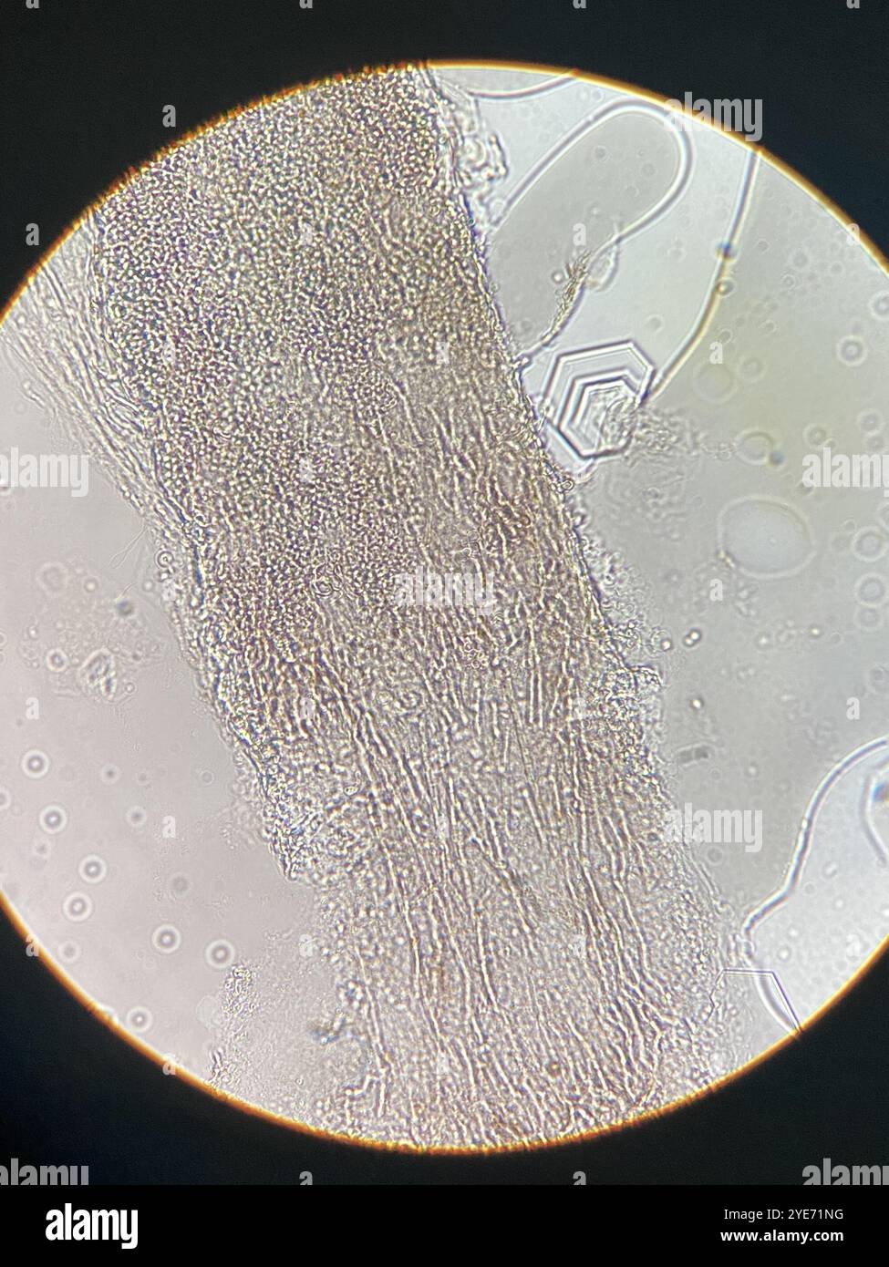 Image dermatoscopique d'un cheveu d'un garçon hispanique de 9 ans ...