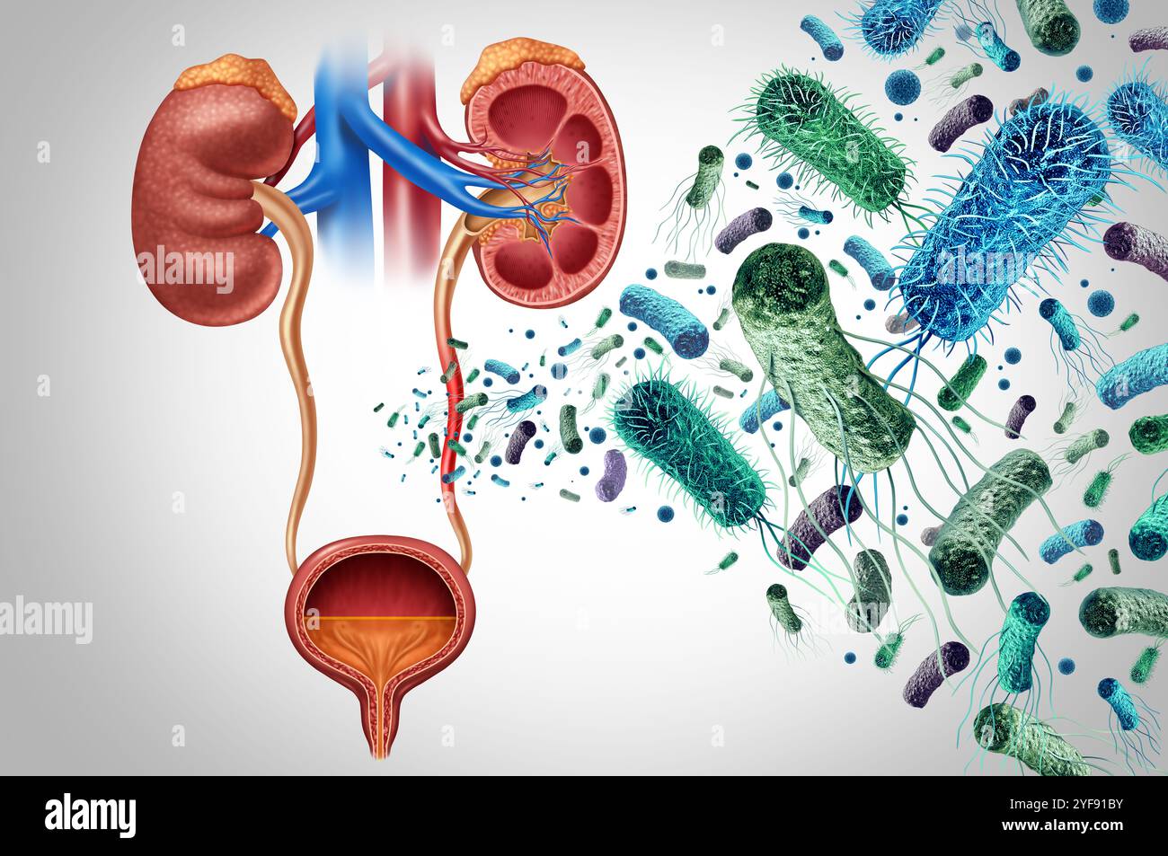 Infection bactérienne des voies urinaires ou anatomie UTI provoquée par ...