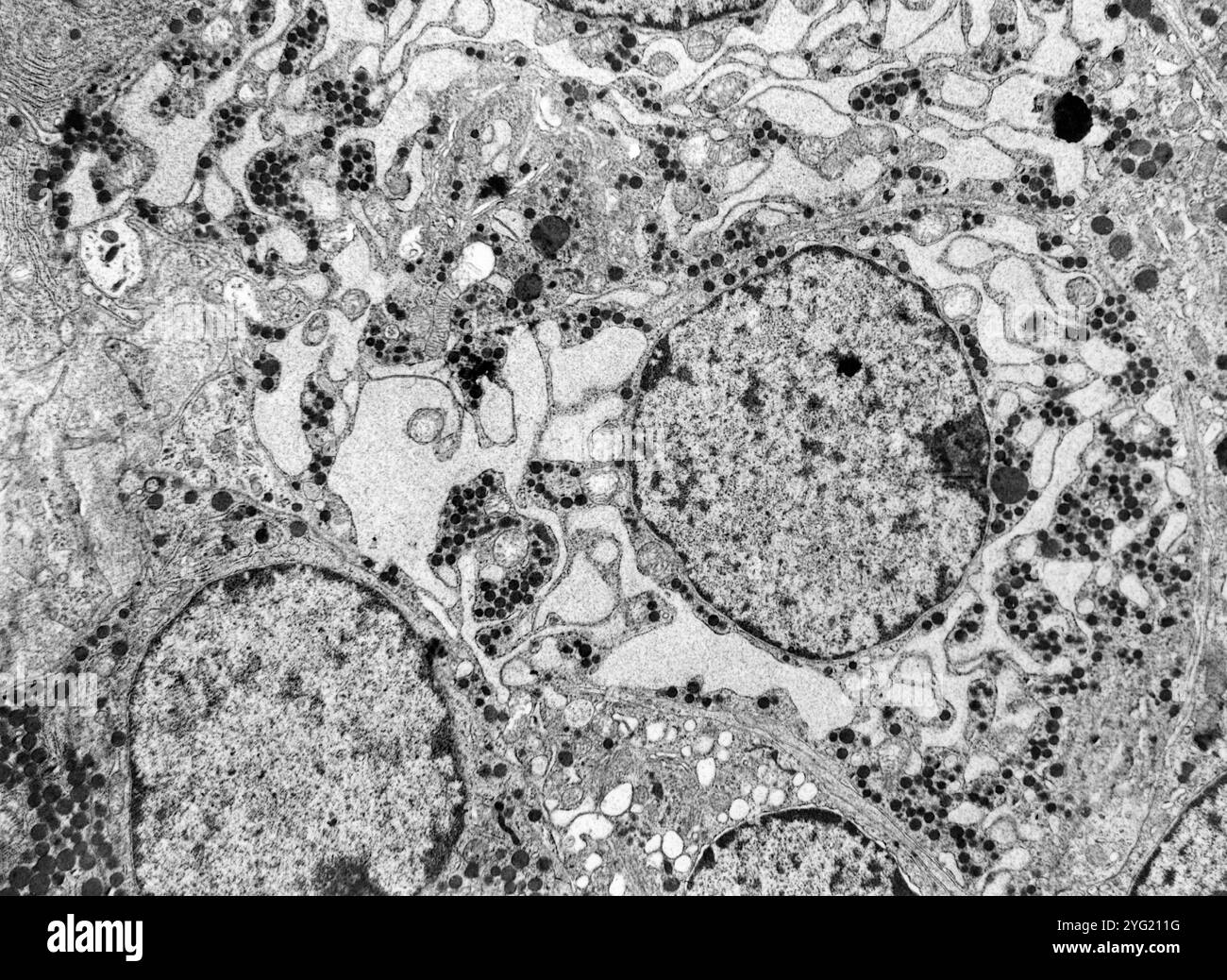 Micrographie électronique en transmission (met) montrant de très ...