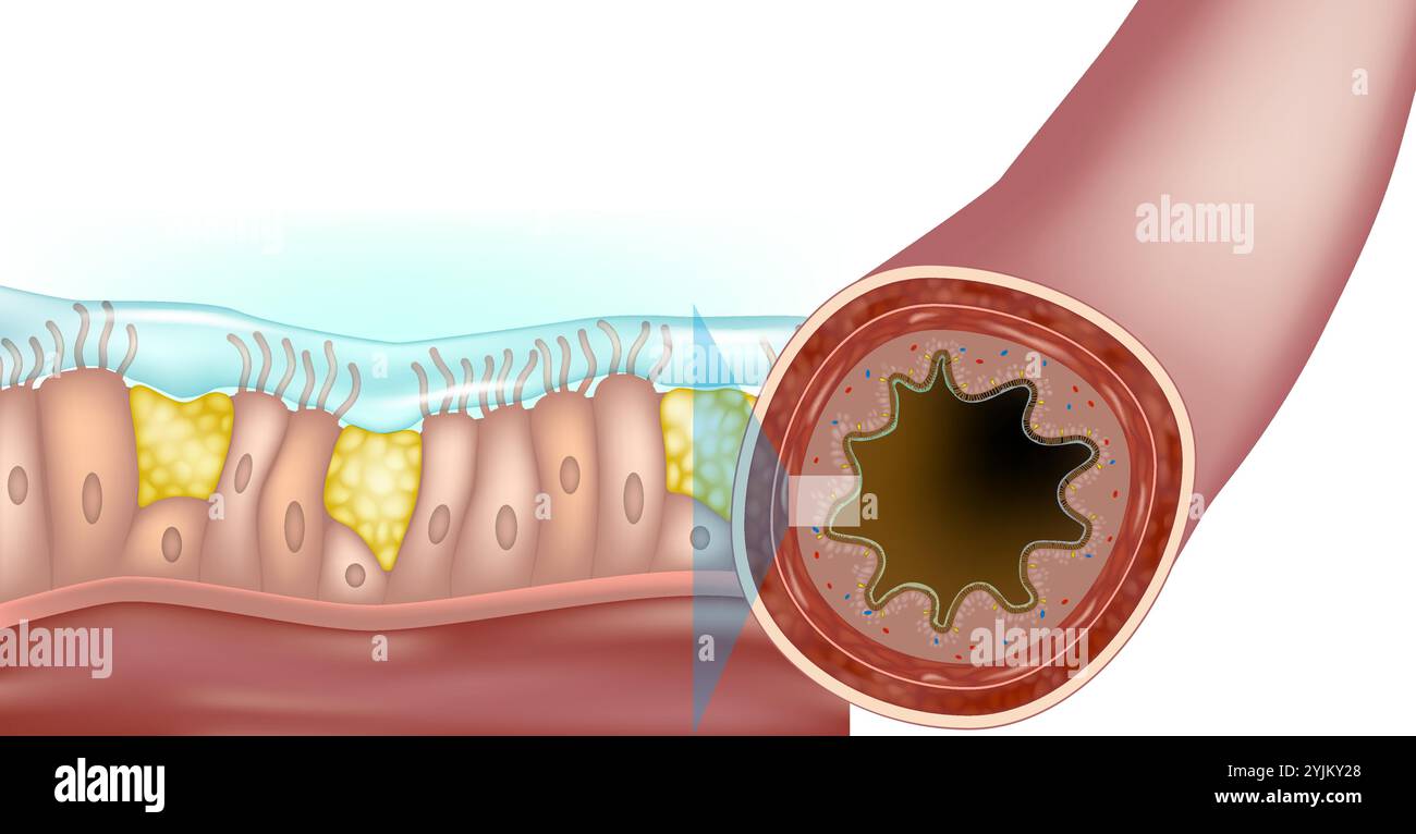 Bronchus. Illustration médicale représentant les cils respiratoires et ...