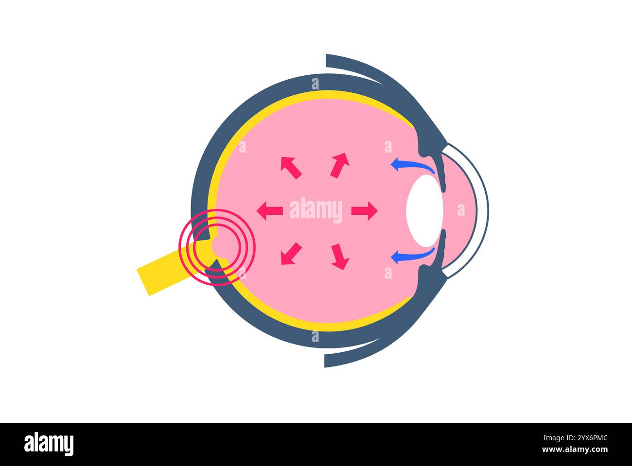 Glaucome et vue Banque de photographies et d’images à haute résolution ...