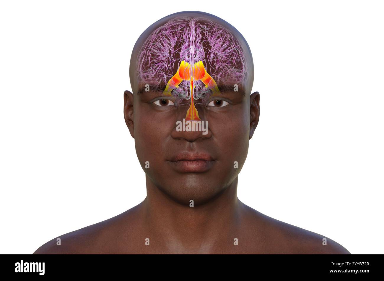 Système ventriculaire du cerveau, illustration informatique. Les ...