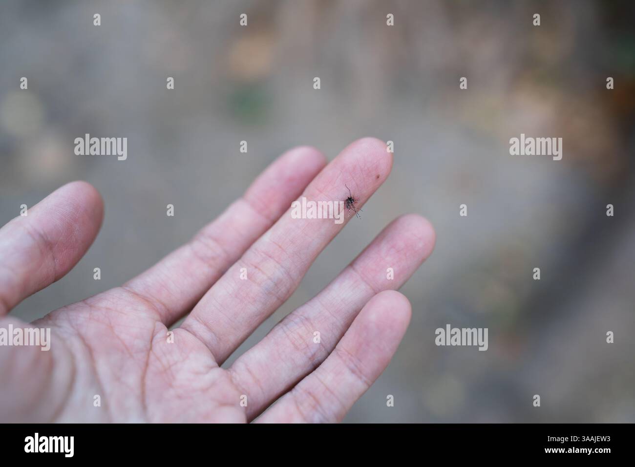 Piqure de moustique et enflure Banque de photographies et d’images à ...