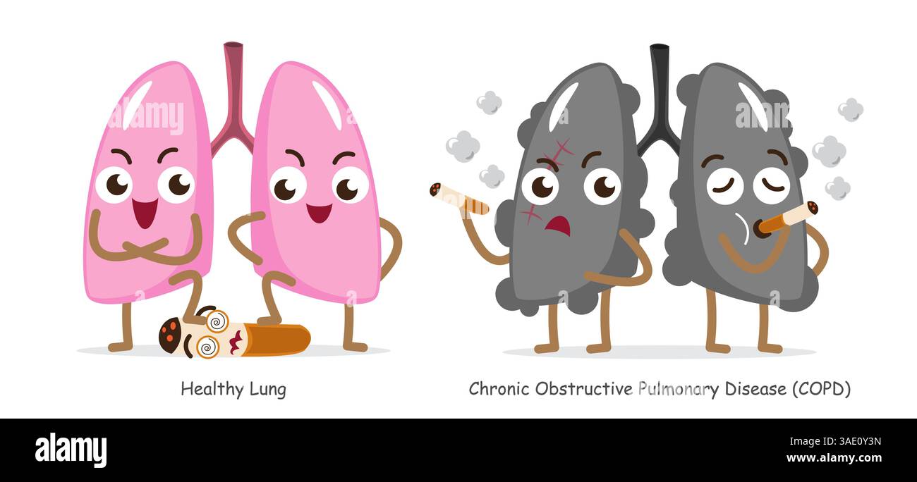 Poumon sain et BPCO poumon et cigarette. Personnages de dessins animés ...