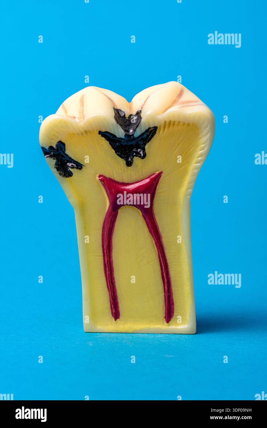Anatomie se la cavité buccale Banque de photographies et d’images à ...