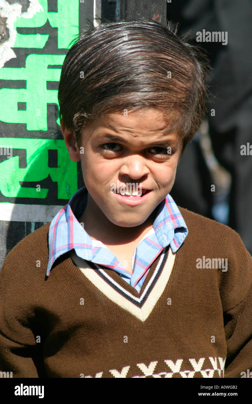 Un nain de Bikaner inde Photo Stock - Alamy