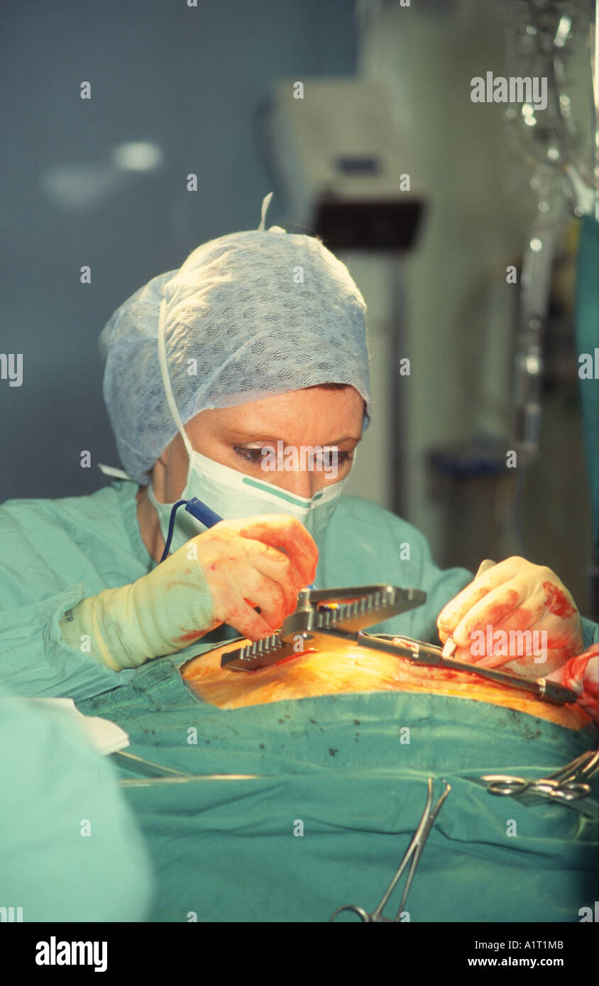 Pontage cardiaque Banque de photographies et d’images à haute ...