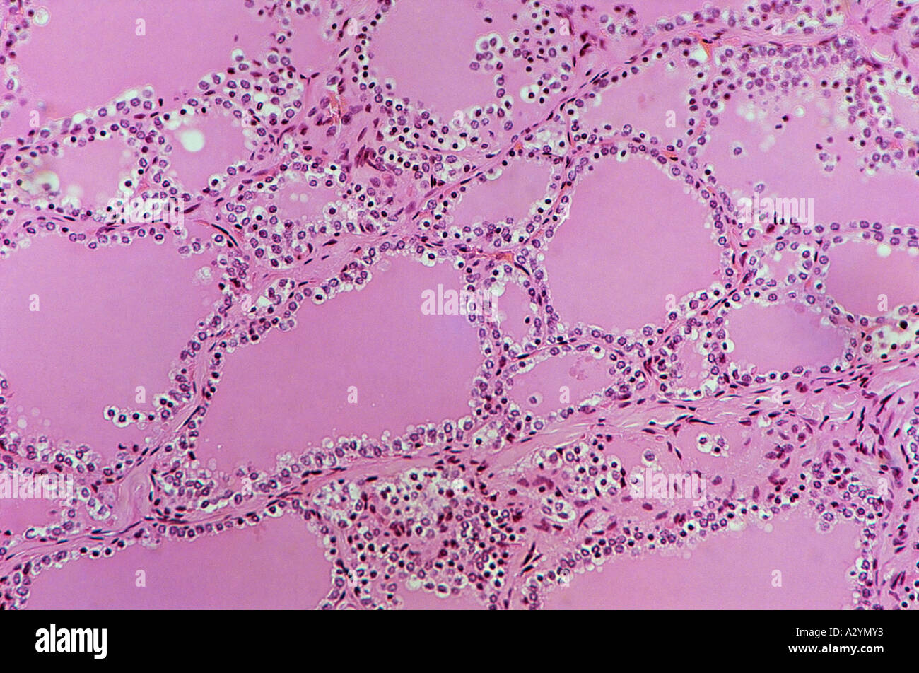 Des follicules thyroïdiens en colloïdes Photo Stock - Alamy