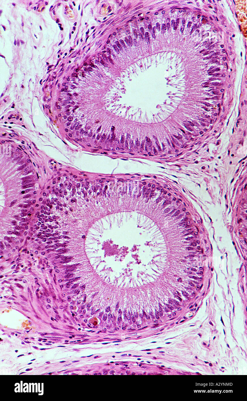 Épididyme microscopie Banque de photographies et d’images à haute ...