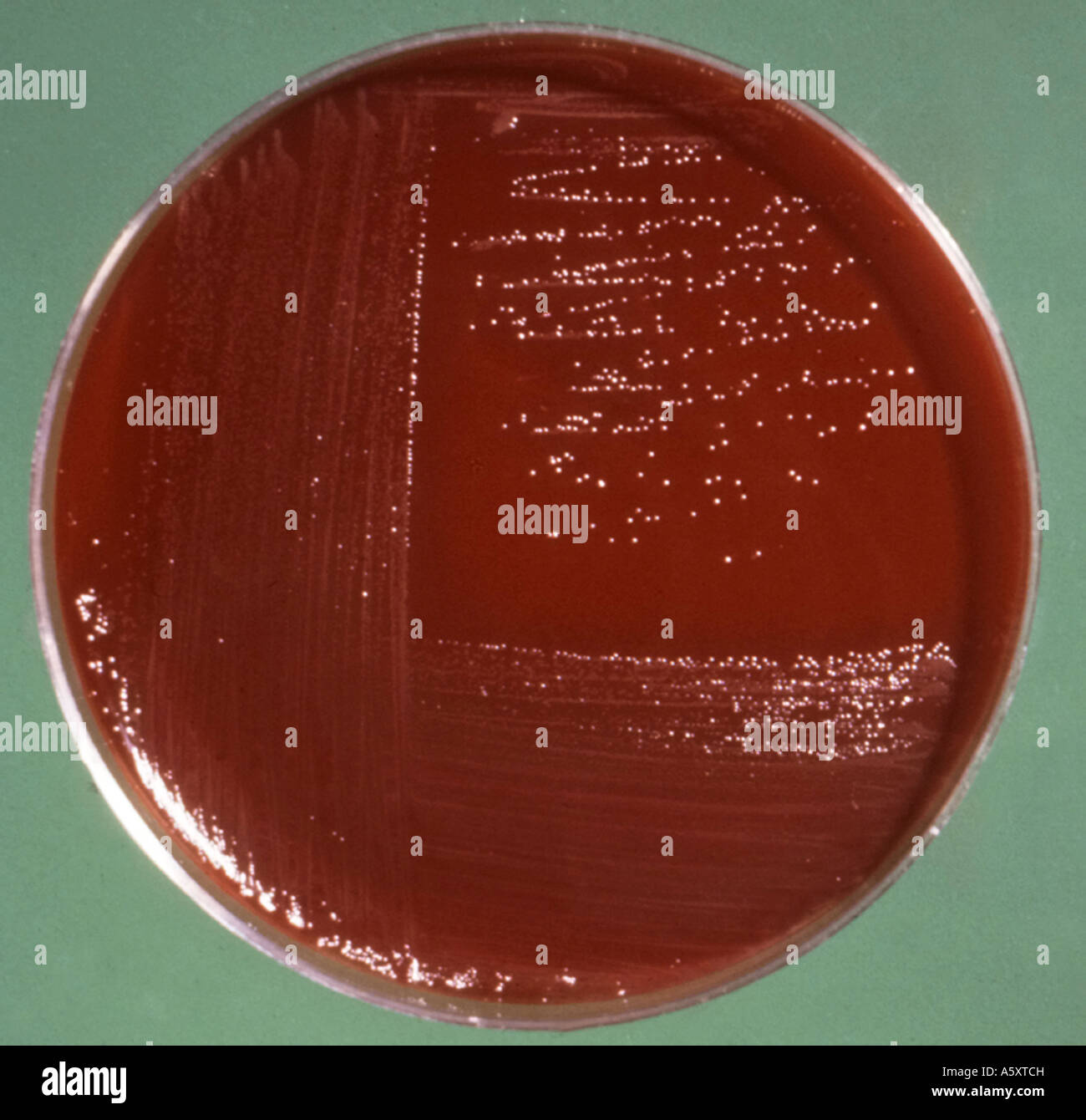 Bactérie d'origine alimentaire de la sous-espèce jejuni Vibrio ...