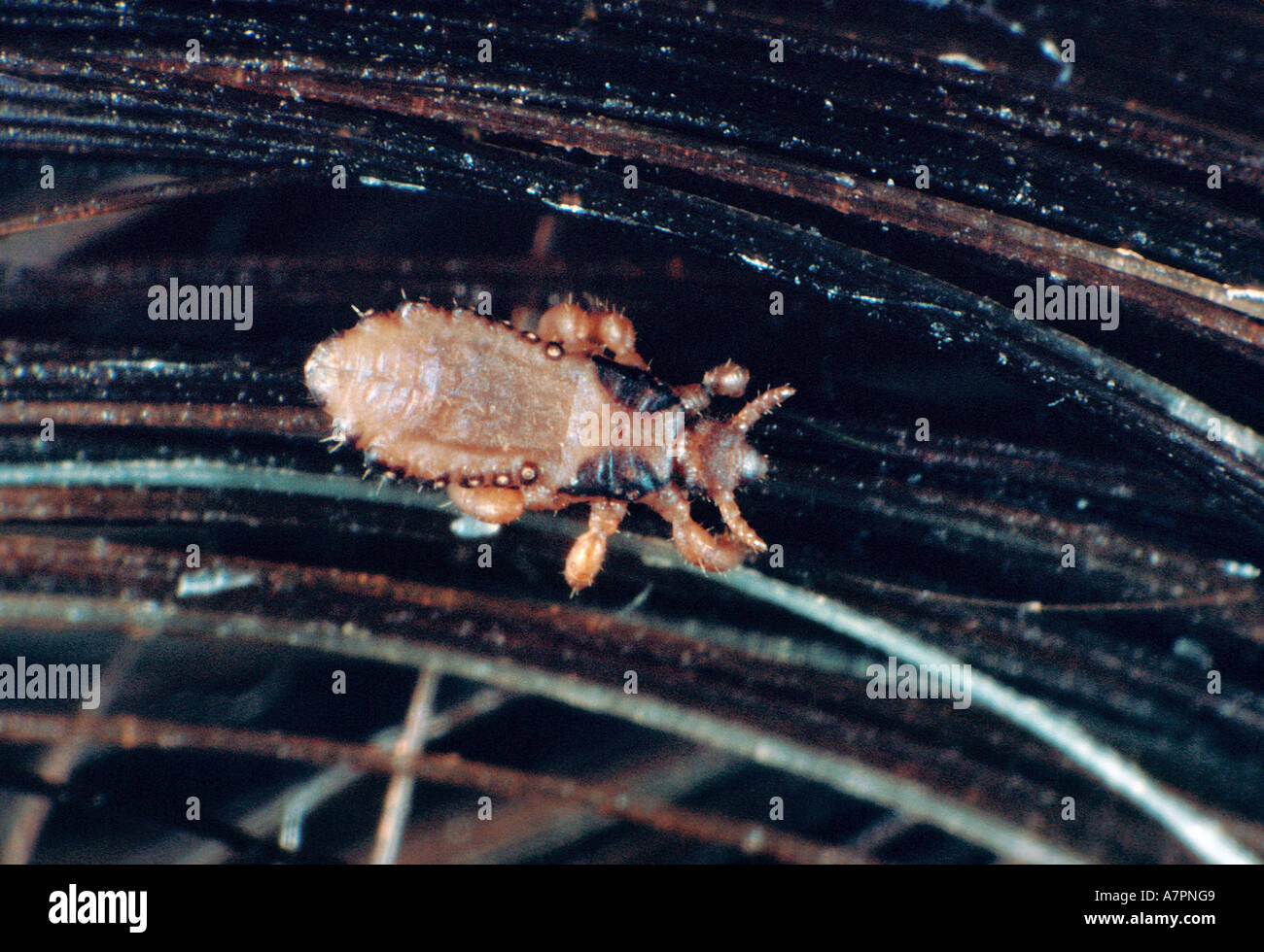 Pediculus humanus capitis Banque de photographies et d’images à haute ...