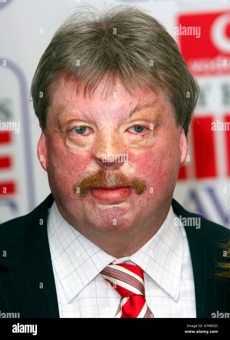 Simon weston Banque de photographies et d’images à haute résolution - Alamy
