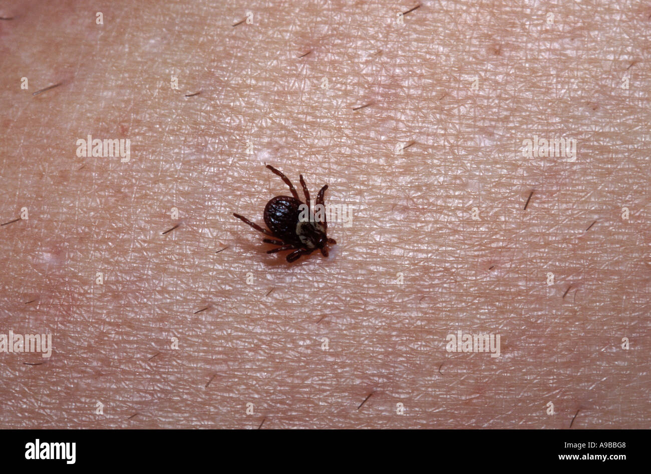 Tique se nourrissant d'humain Banque de photographies et d’images à ...