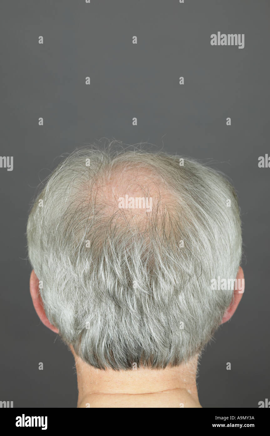 Homme chauve moche Banque de photographies et d’images à haute ...