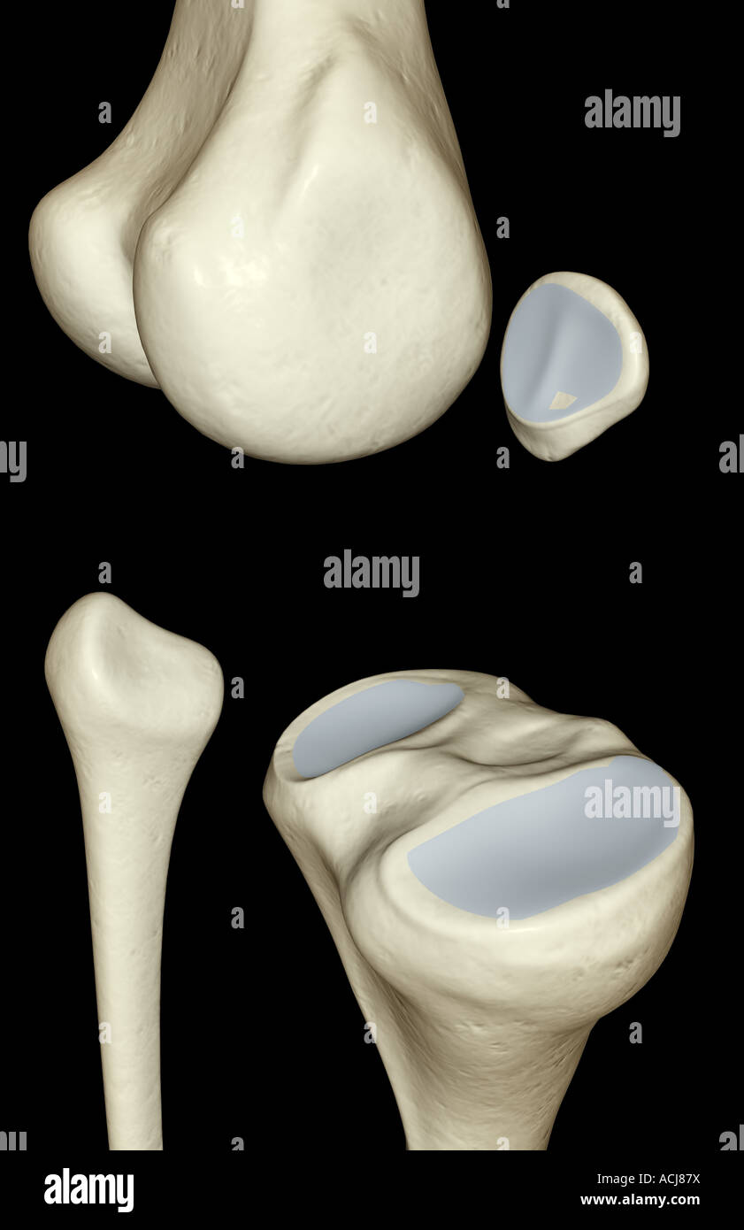 Medial Condyle Banque d'image et photos - Page 2 - Alamy