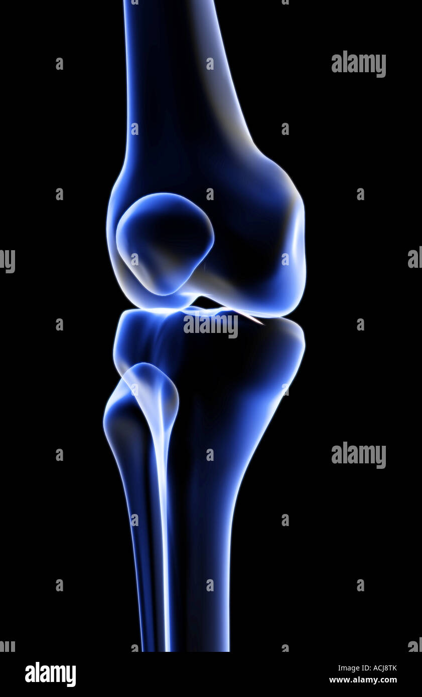 Radiographie du genou Banque de photographies et d’images à haute ...
