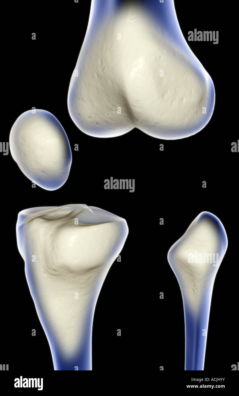 Tibial Condyle Banque d'image et photos - Alamy