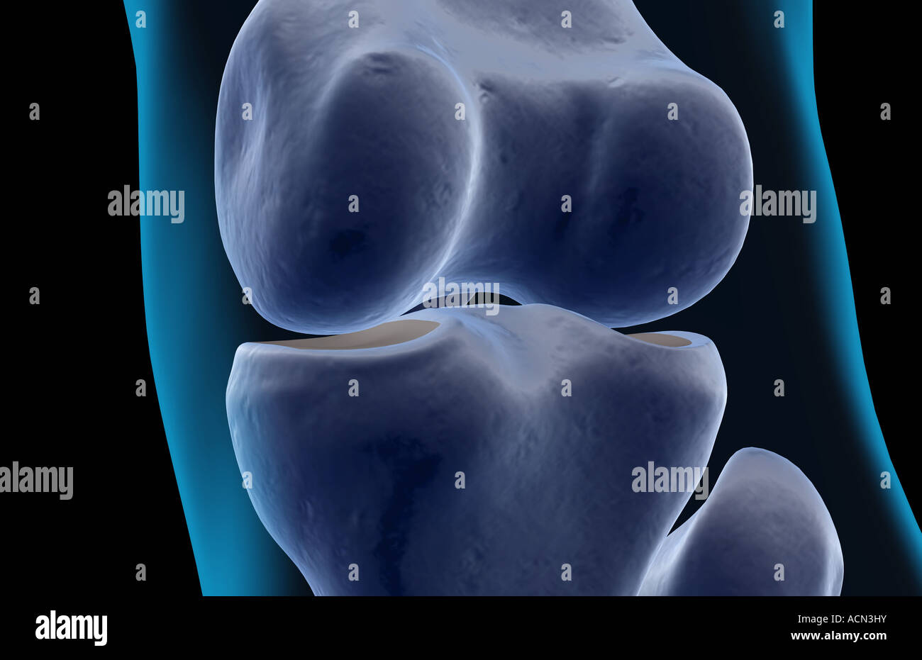 Medial Condyle Banque d'image et photos - Alamy