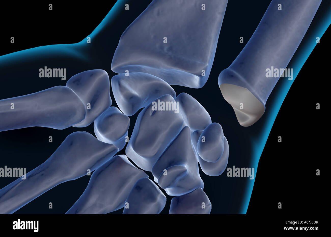 Anatomie du carpe du poignet Banque de photographies et d’images à ...