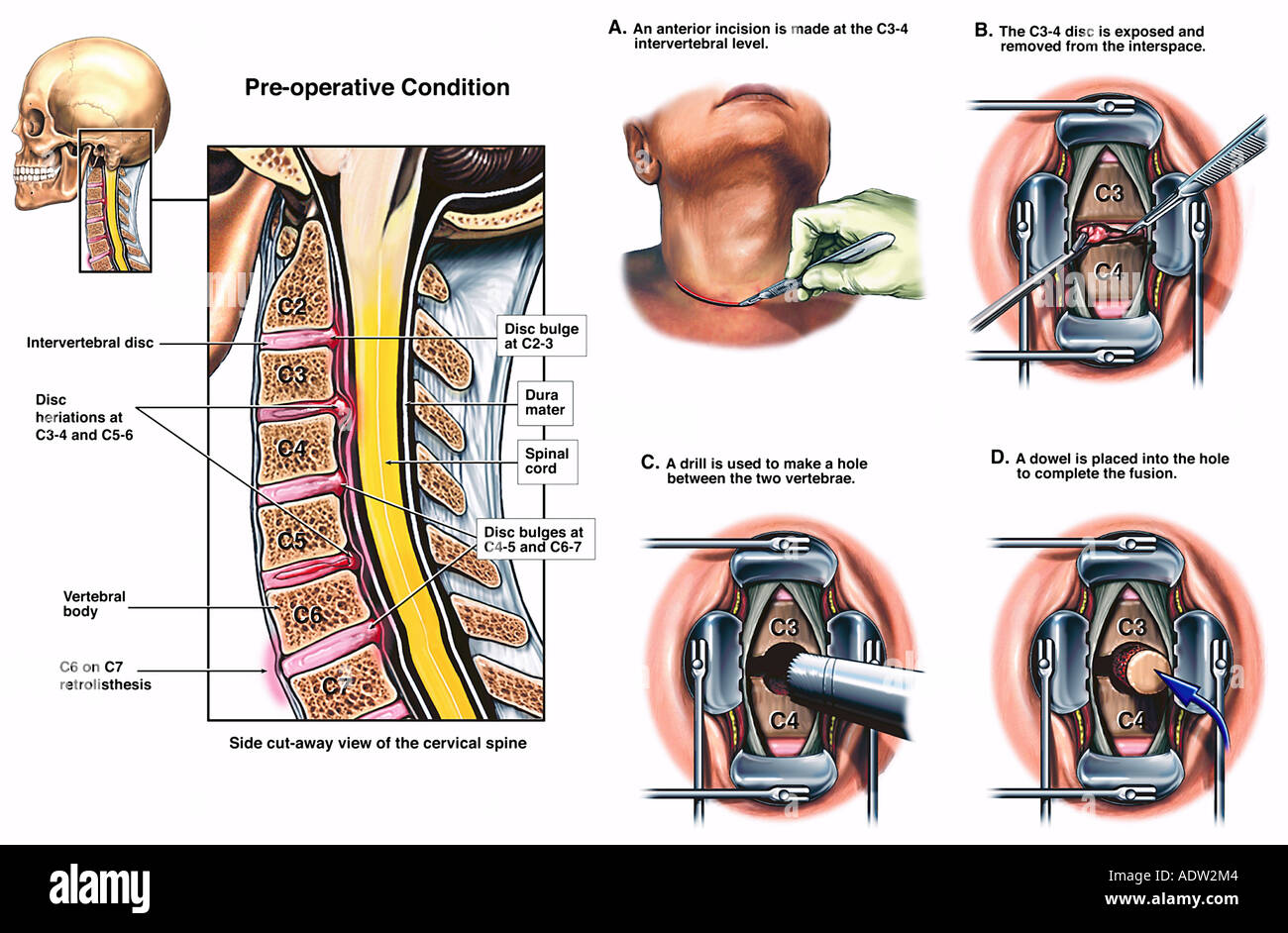 C4 c7 Banque de photographies et d’images à haute résolution - Alamy