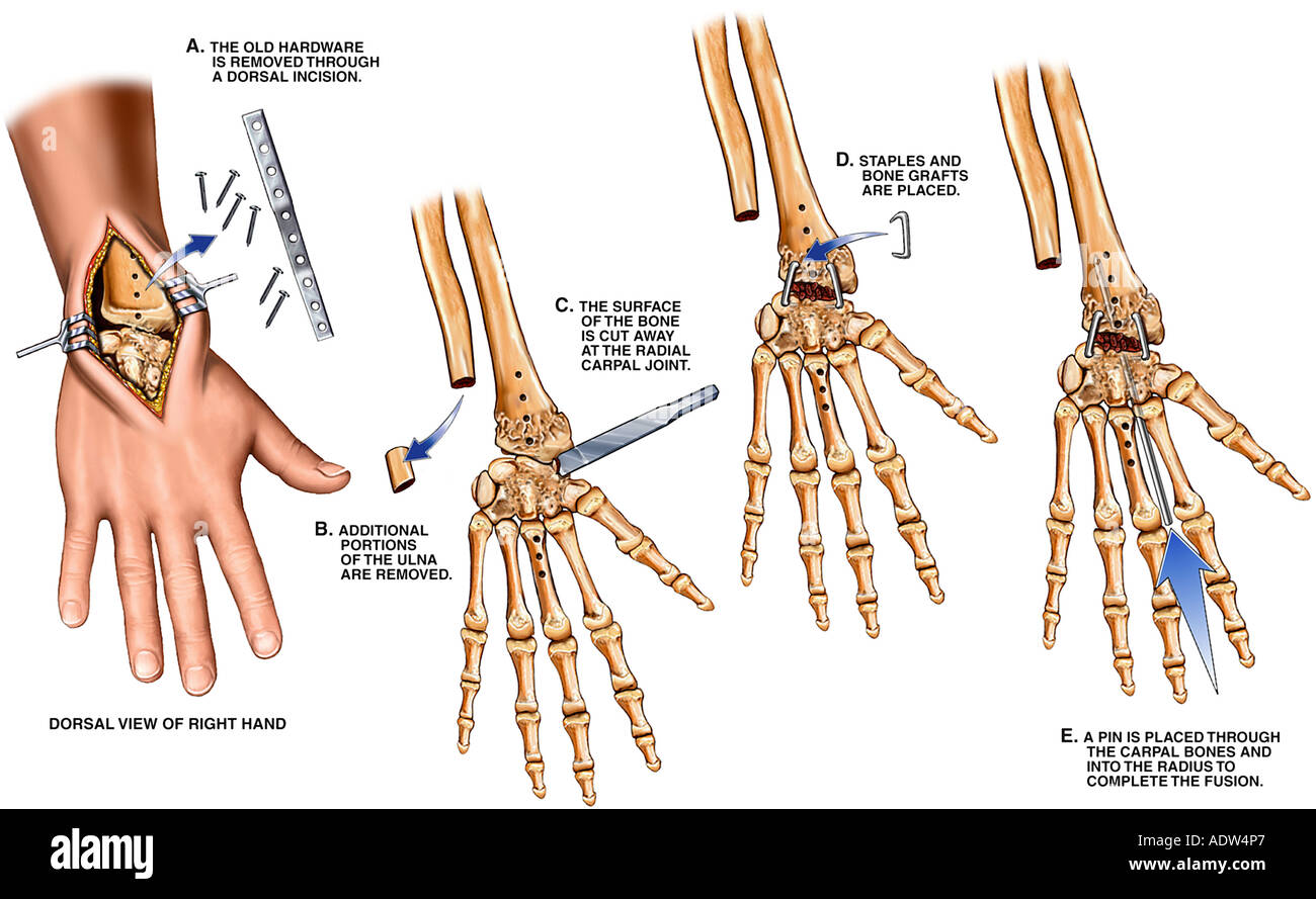 Articulation du poignet Banque de photographies et d’images à haute ...