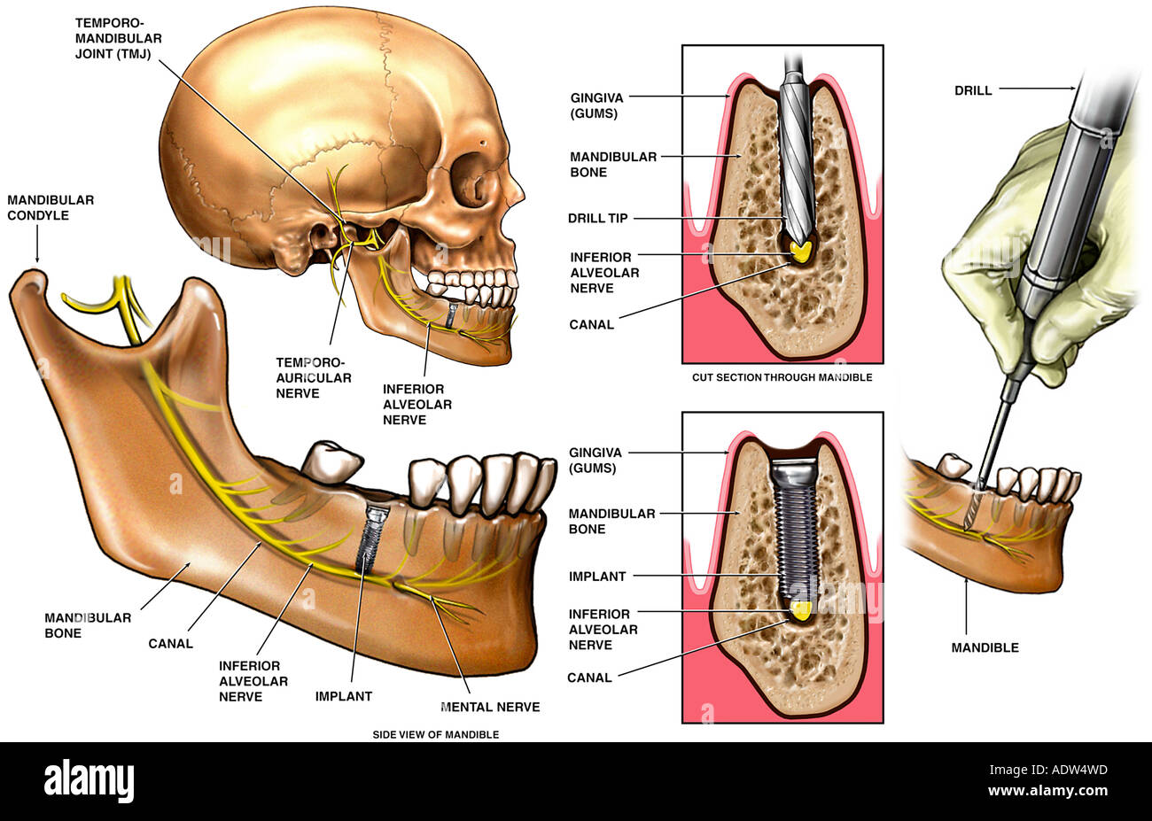 Nerf mandibulaire Banque de photographies et d’images à haute ...