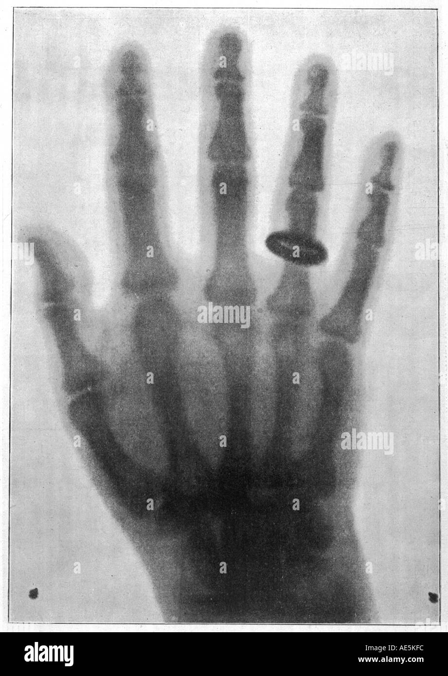 Radiographie de rontgen Banque de photographies et d’images à haute ...