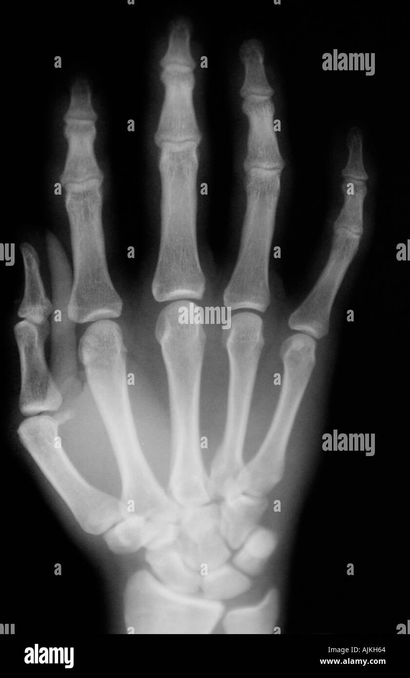 Os de la main Banque d'images noir et blanc - Alamy