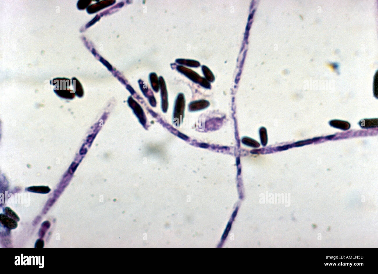 Candida albicans Banque de photographies et d’images à haute résolution ...